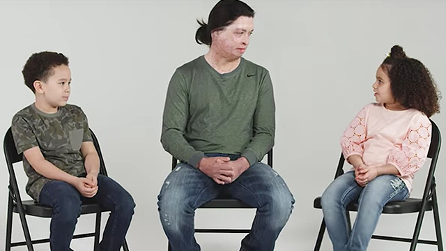 Kids Learn Burn Survivor's Inspiring Story | RTM - RightThisMinute